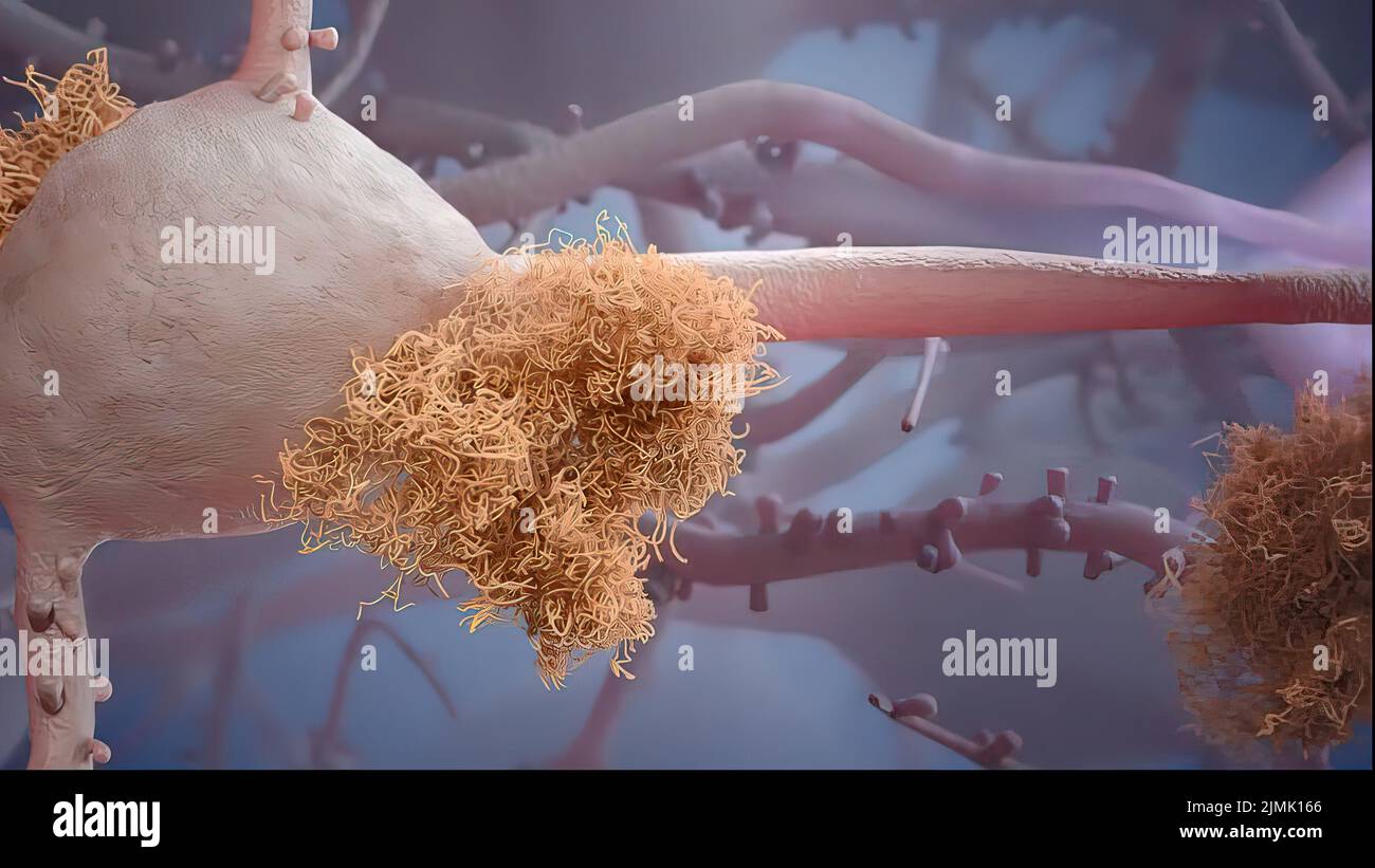 Neuroactivity hi-res stock photography and images - Alamy