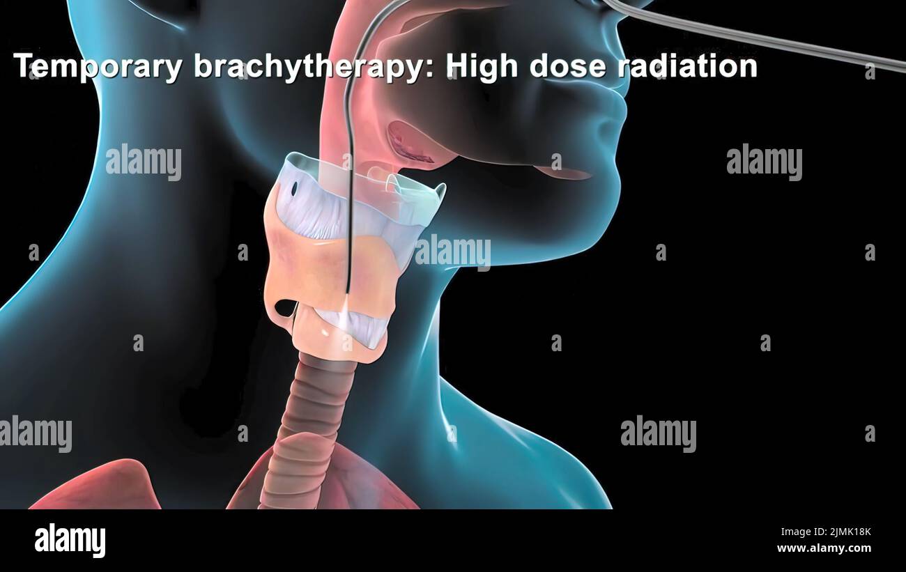 Medical illustration body render lungs hi-res stock photography and ...