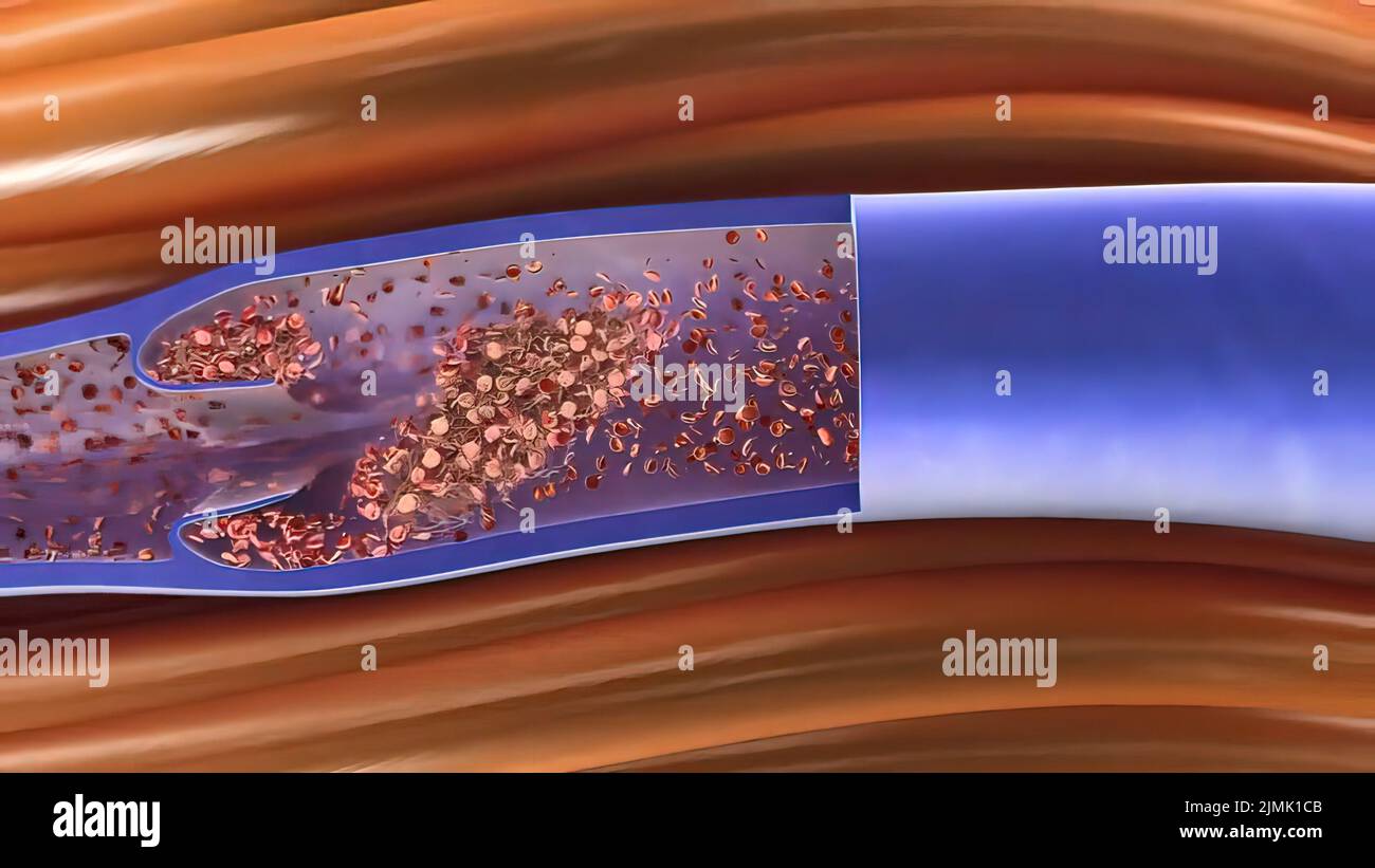 Leukemia cell death hi-res stock photography and images - Alamy