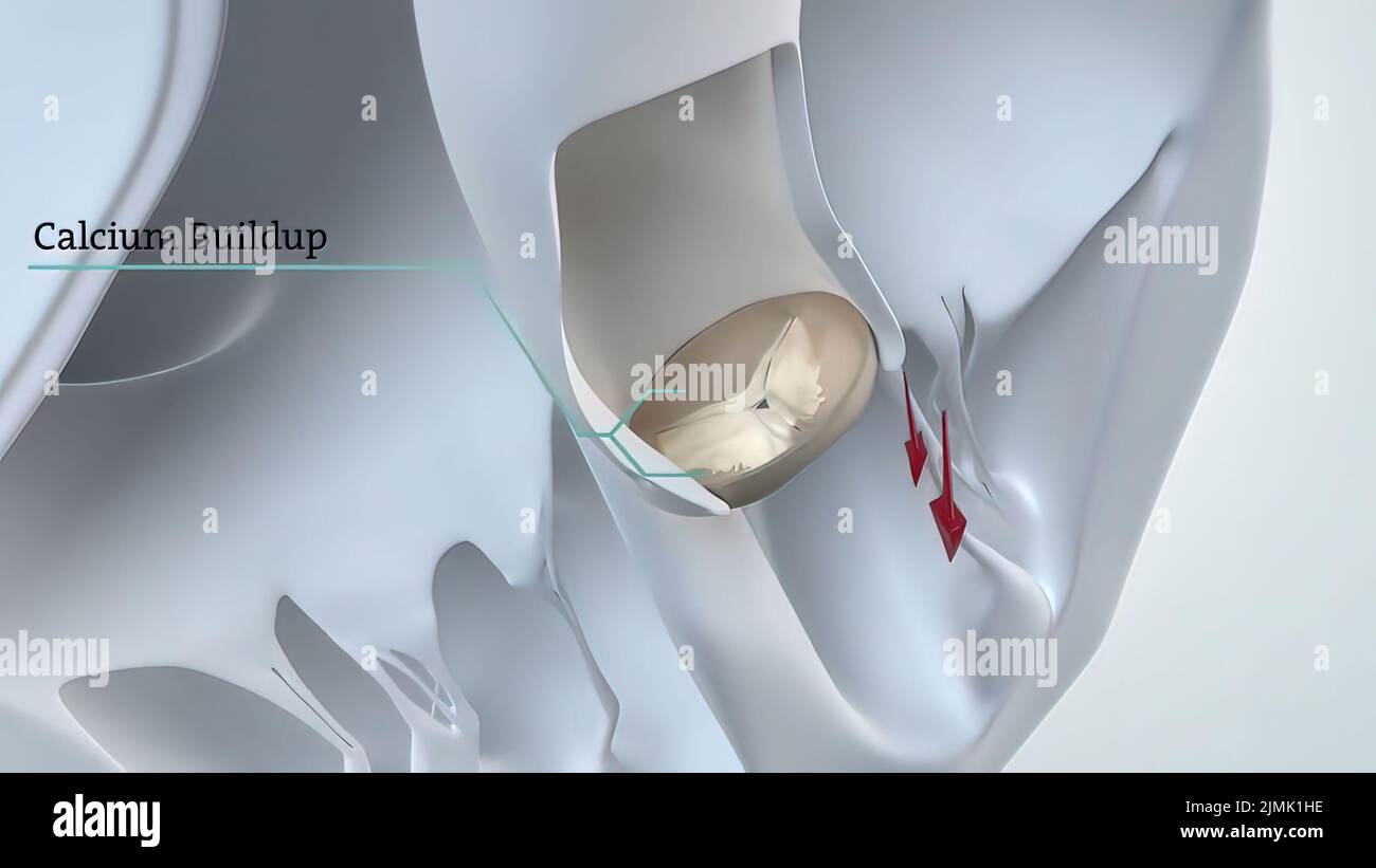Aortic valve human heart hi-res stock photography and images - Alamy