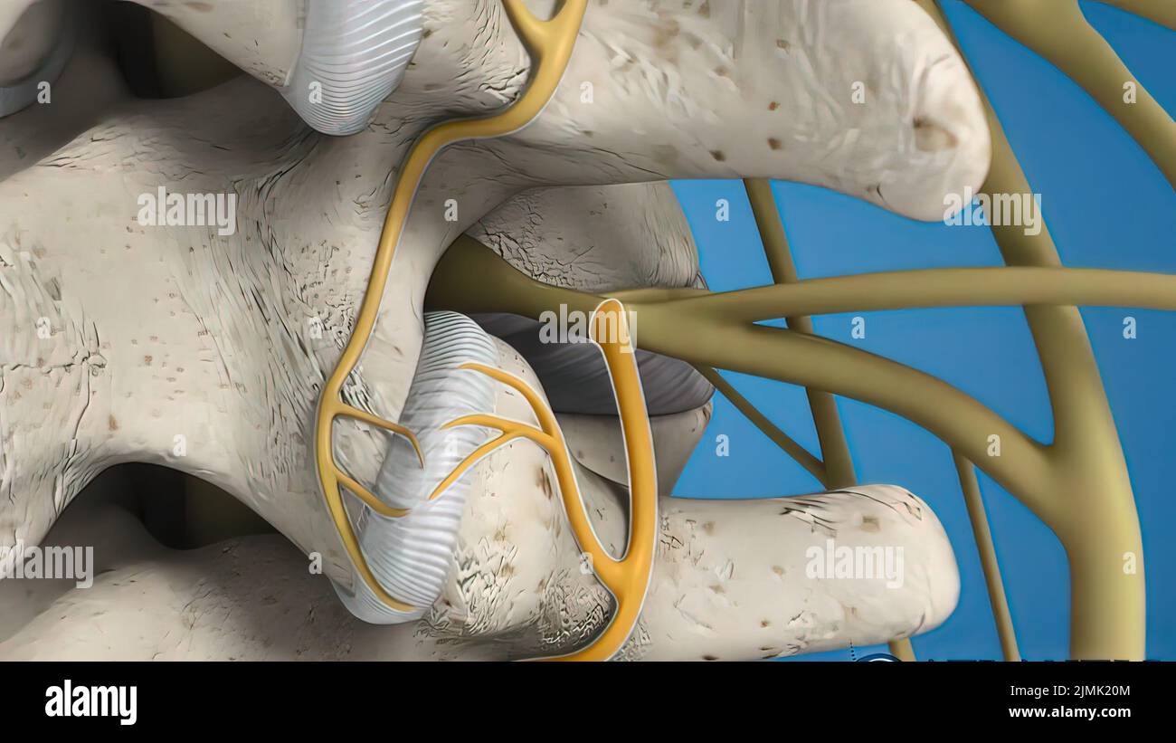 Brain with legs hi-res stock photography and images - Alamy
