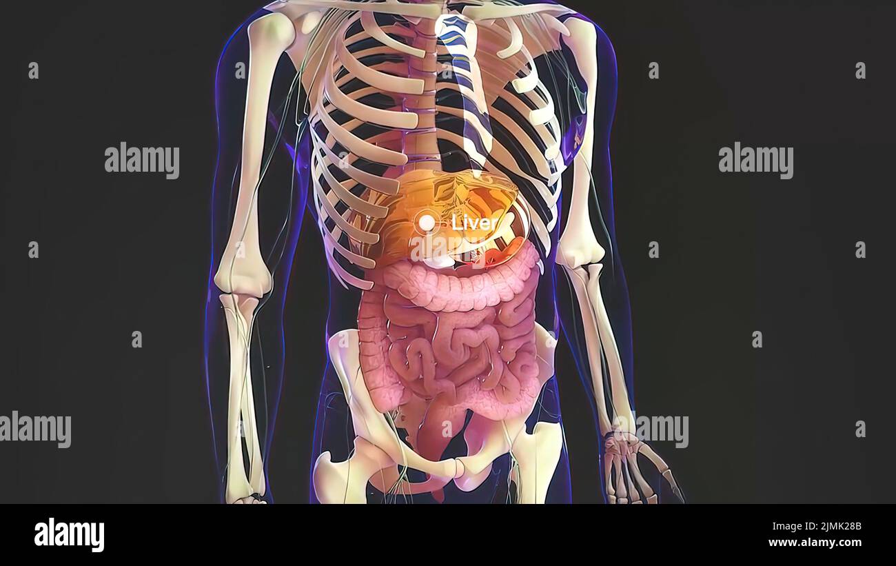 Human body anatomy inflammation x ray hi-res stock photography and ...