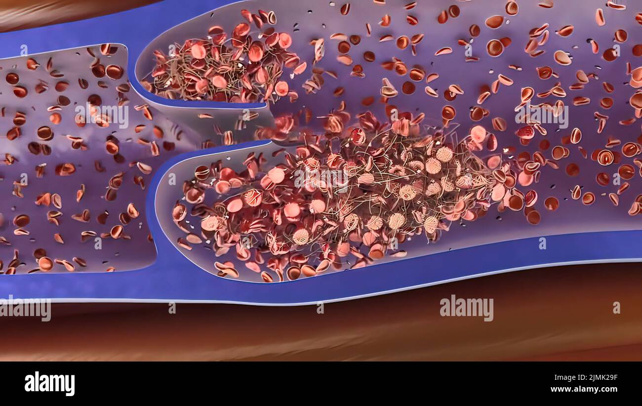 Leukemia cell death hi-res stock photography and images - Alamy