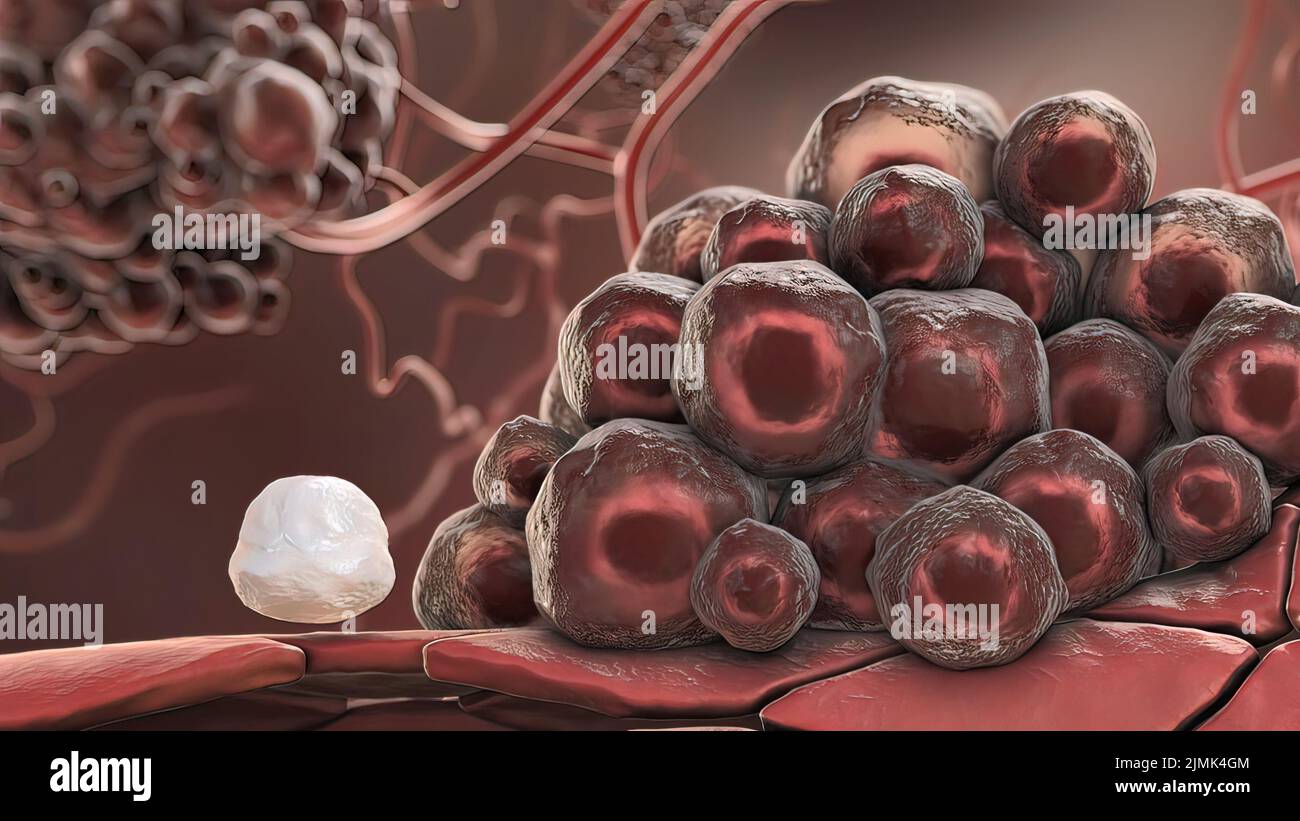 Cancer cells blood hi-res stock photography and images - Alamy