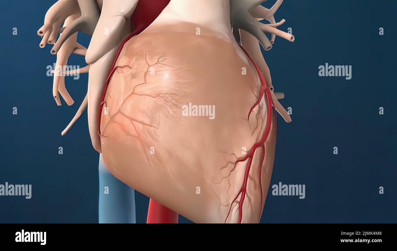 Narrowed coronary arteries hi-res stock photography and images - Alamy