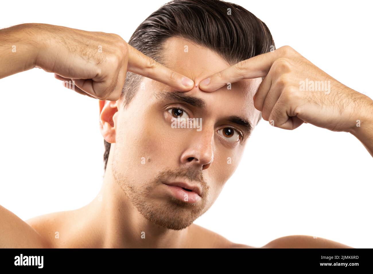 Young man is squeezing pimple on his forehead Stock Photo - Alamy