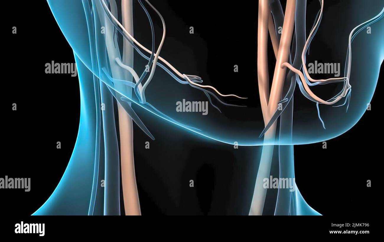 Blocked vein hi-res stock photography and images - Alamy