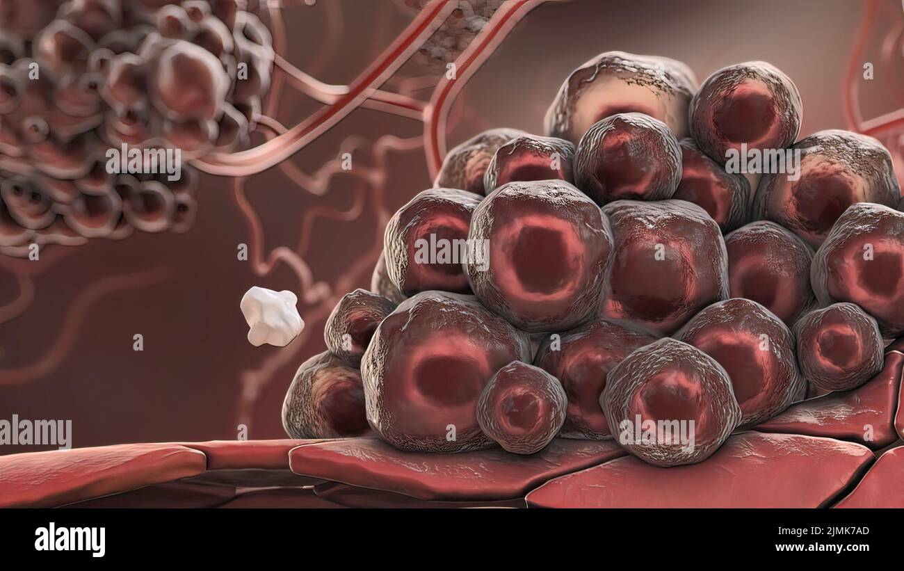 Blood cancer cells hi-res stock photography and images - Alamy