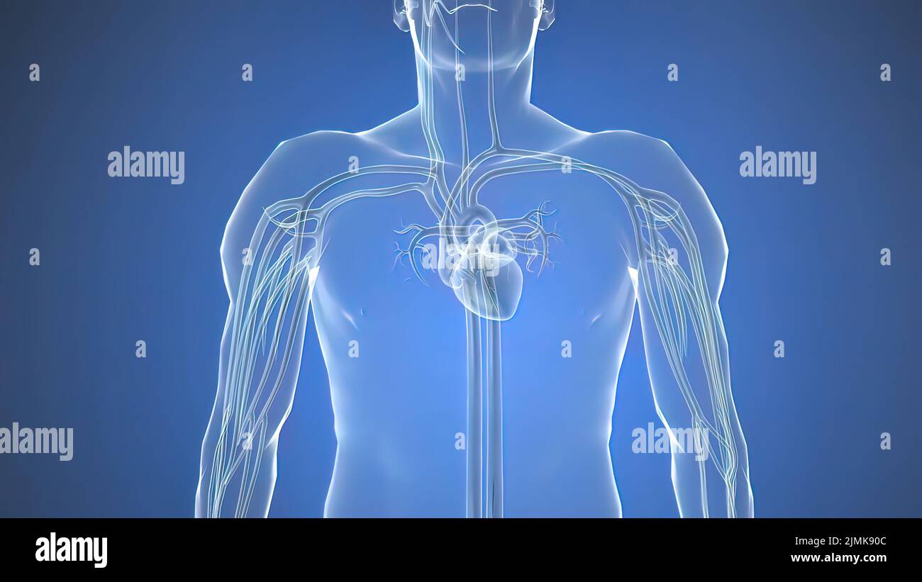 Occluded blood vessel hi-res stock photography and images - Alamy