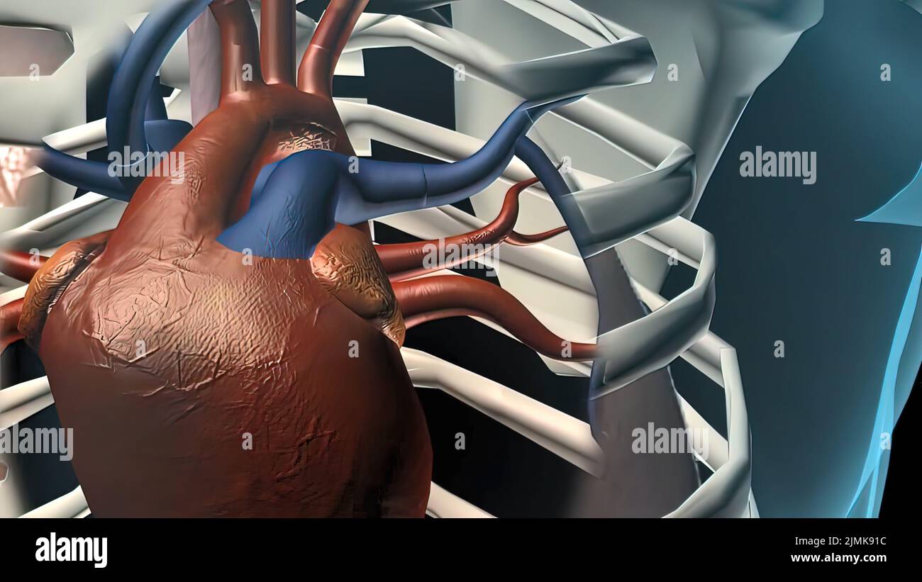 Human heart blood clot hi-res stock photography and images - Alamy