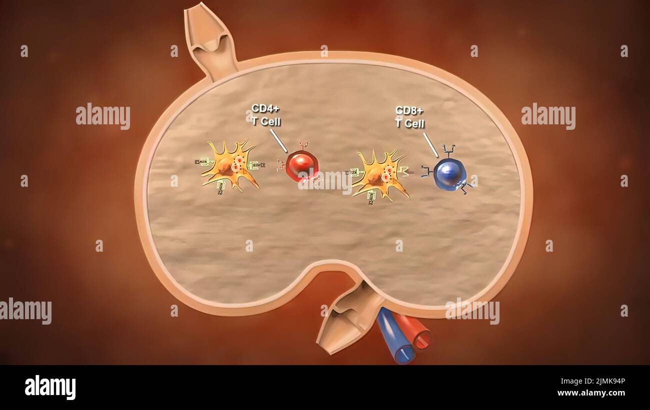 Mast cell histamine hi-res stock photography and images - Alamy