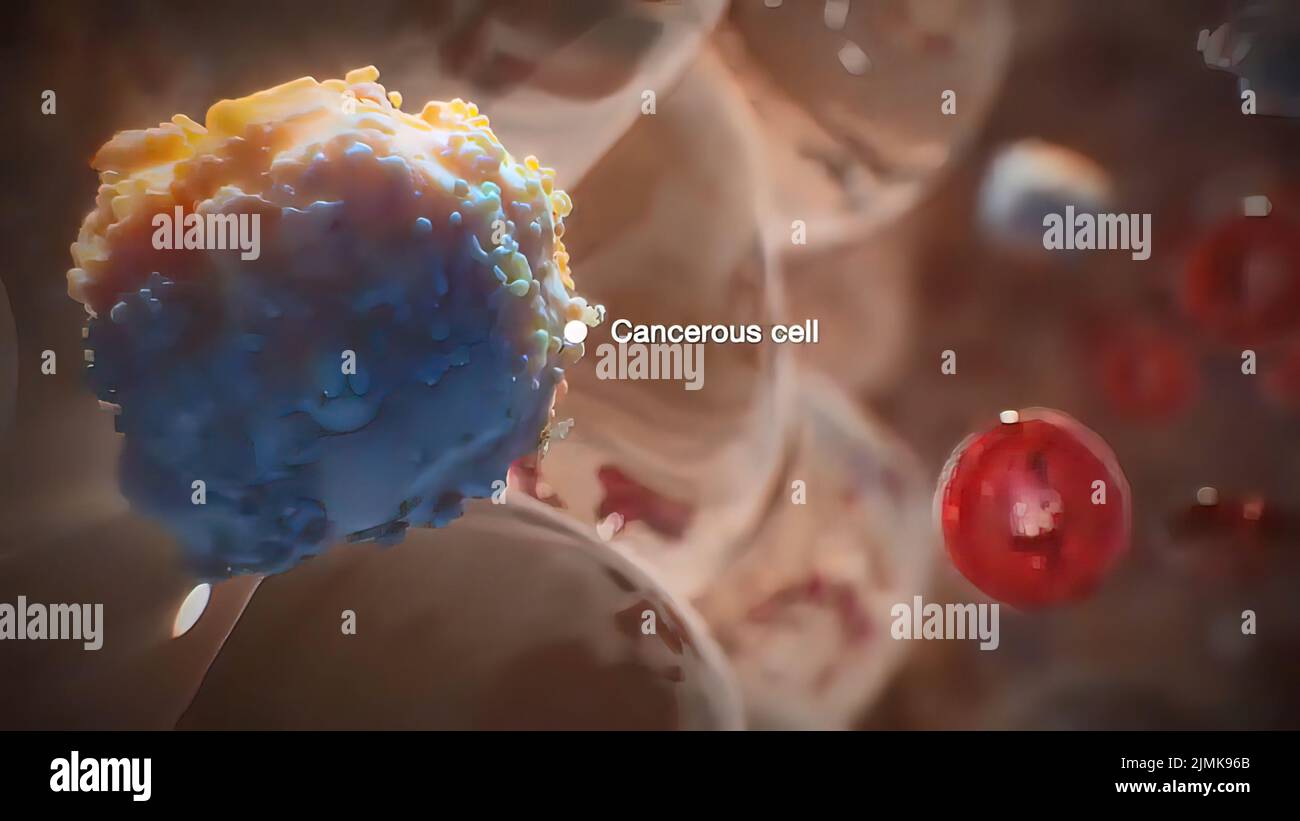 Blood cancer cells hi-res stock photography and images - Alamy