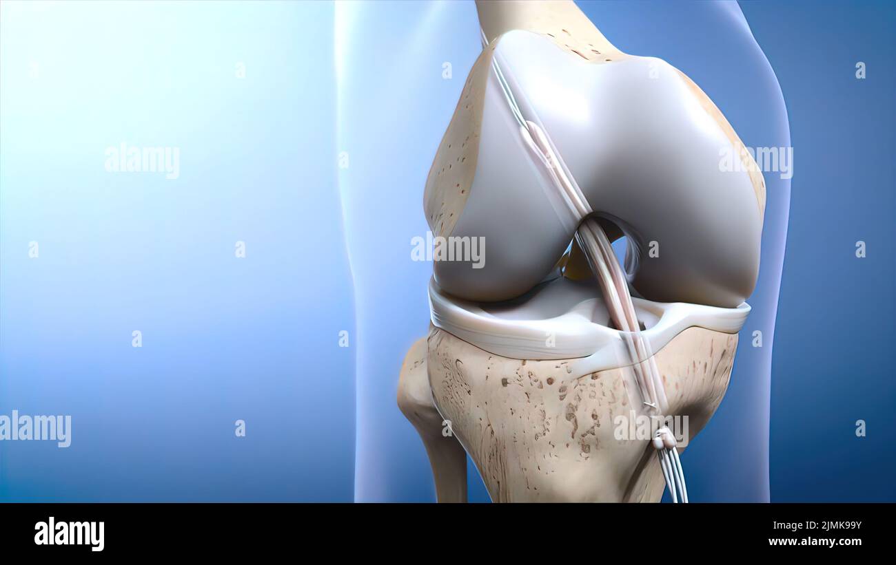 Anterior cruciate ligament tear hi-res stock photography and images - Alamy