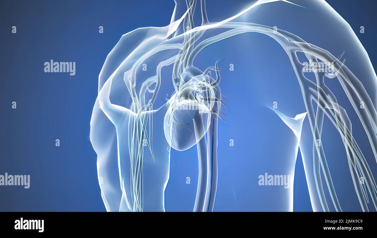 Coronary angiogram stent hi-res stock photography and images - Alamy