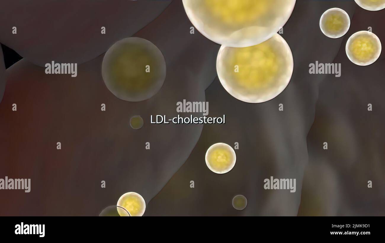 Blood in a artery hi-res stock photography and images - Alamy