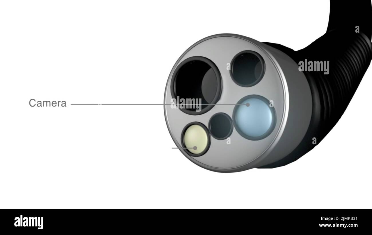 Colonoscopy test Cut Out Stock Images & Pictures - Alamy