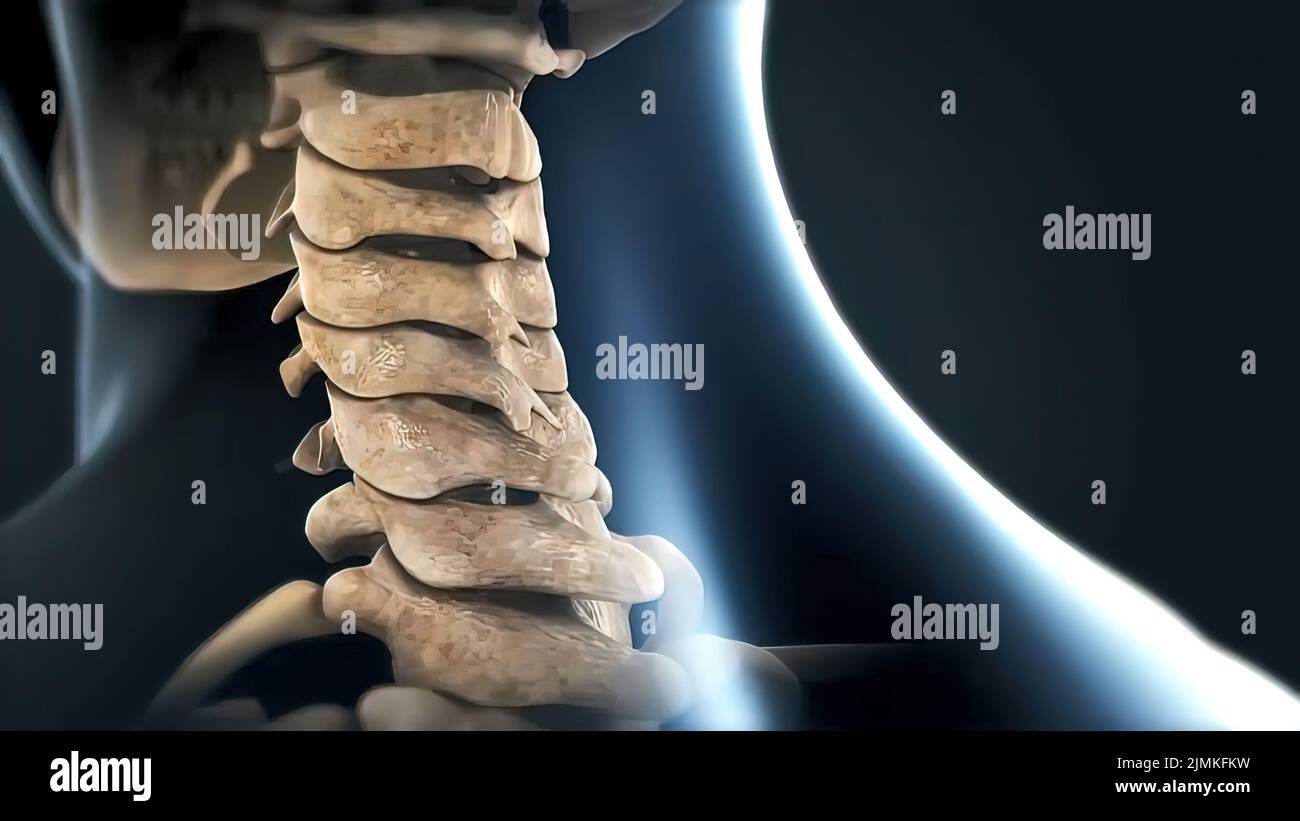 Lumbar vertebra lateral hi-res stock photography and images - Alamy