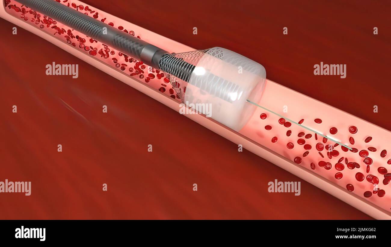 Blood vessel system hi-res stock photography and images - Alamy