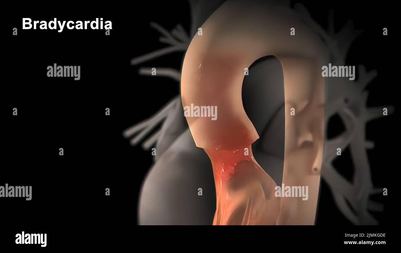 Slow heartbeat hi-res stock photography and images - Alamy