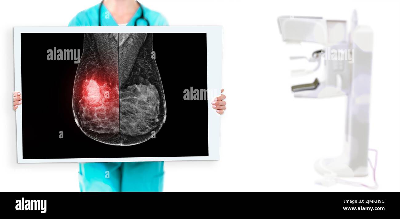 Selective focus female doctor show Mammogram imaging with mammogram ...