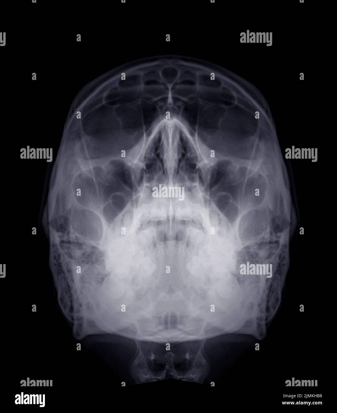Skull x-ray image of Human water's view isolated on Black Background ...