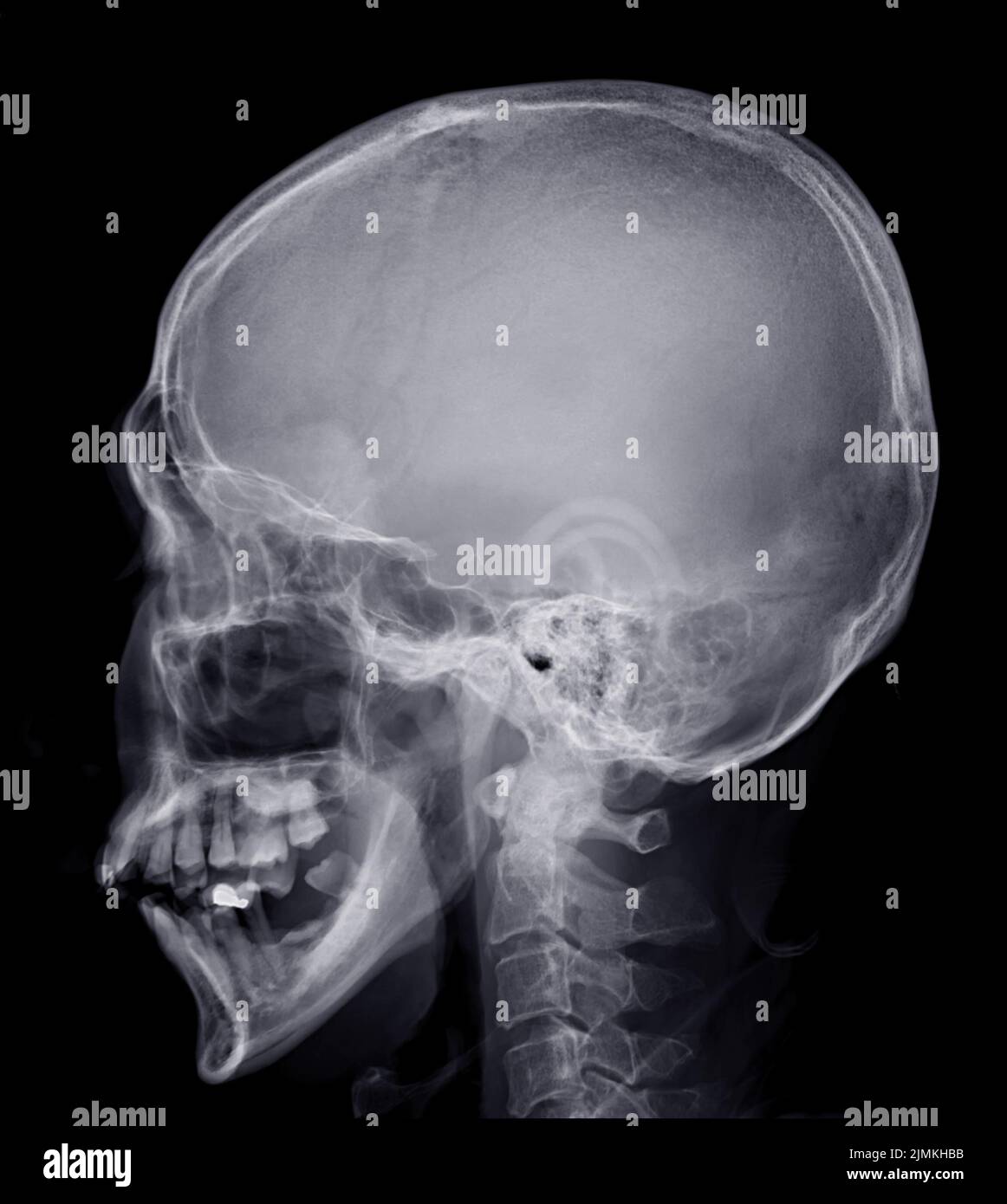 Skull x-ray image of Human name is skull lateral view isolated on Black ...