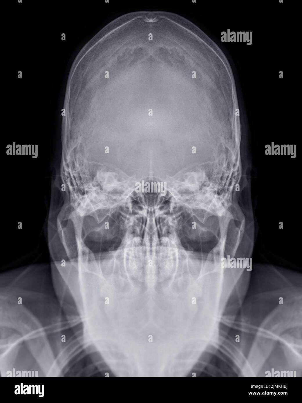 X Ray Of Skull Labelled At Zane Bussell Blog