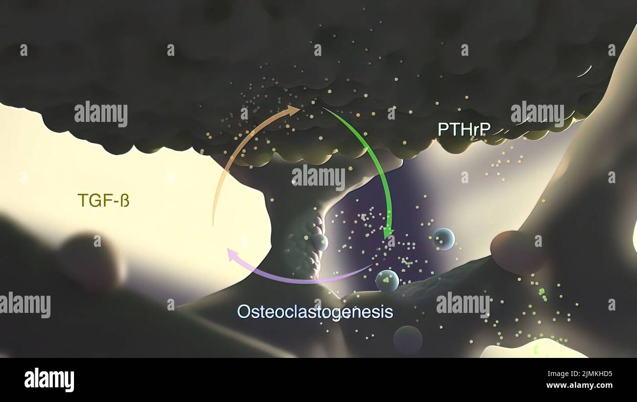 Histology of bone growth hi-res stock photography and images - Alamy