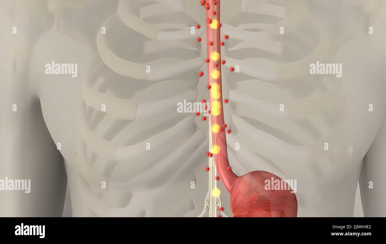 Peristalsis stomach hi-res stock photography and images - Alamy