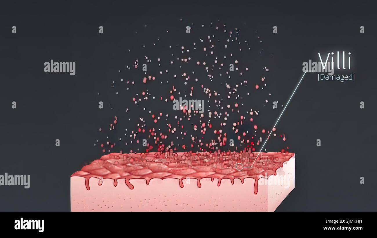 Duodenum microscope hi-res stock photography and images - Alamy