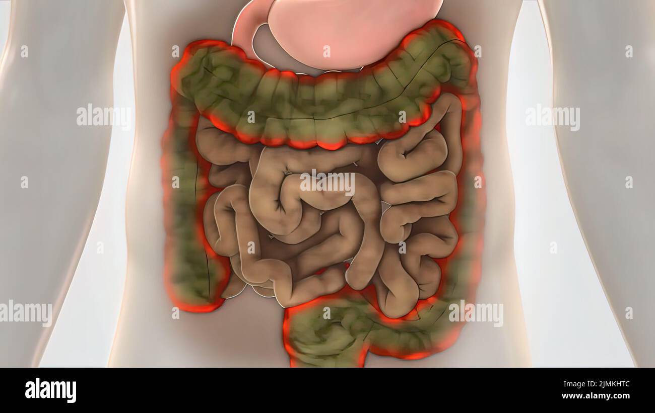 Colonoscopy virtual hi-res stock photography and images - Alamy