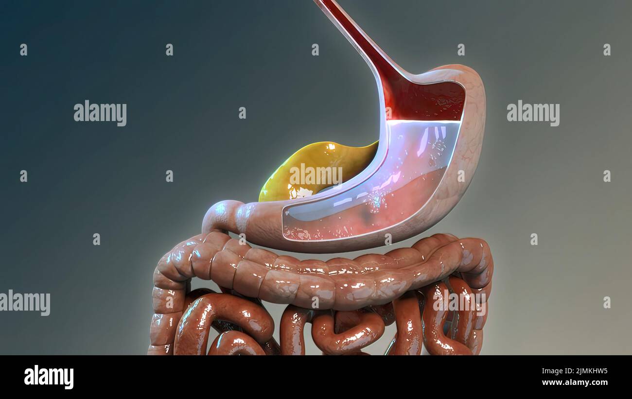 Gastrointestinal tract illustration hi-res stock photography and images ...