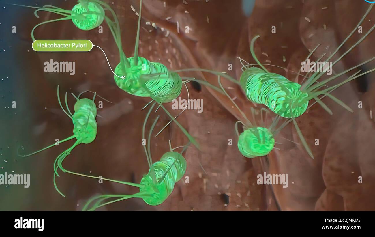 Gastric pits hi-res stock photography and images - Alamy