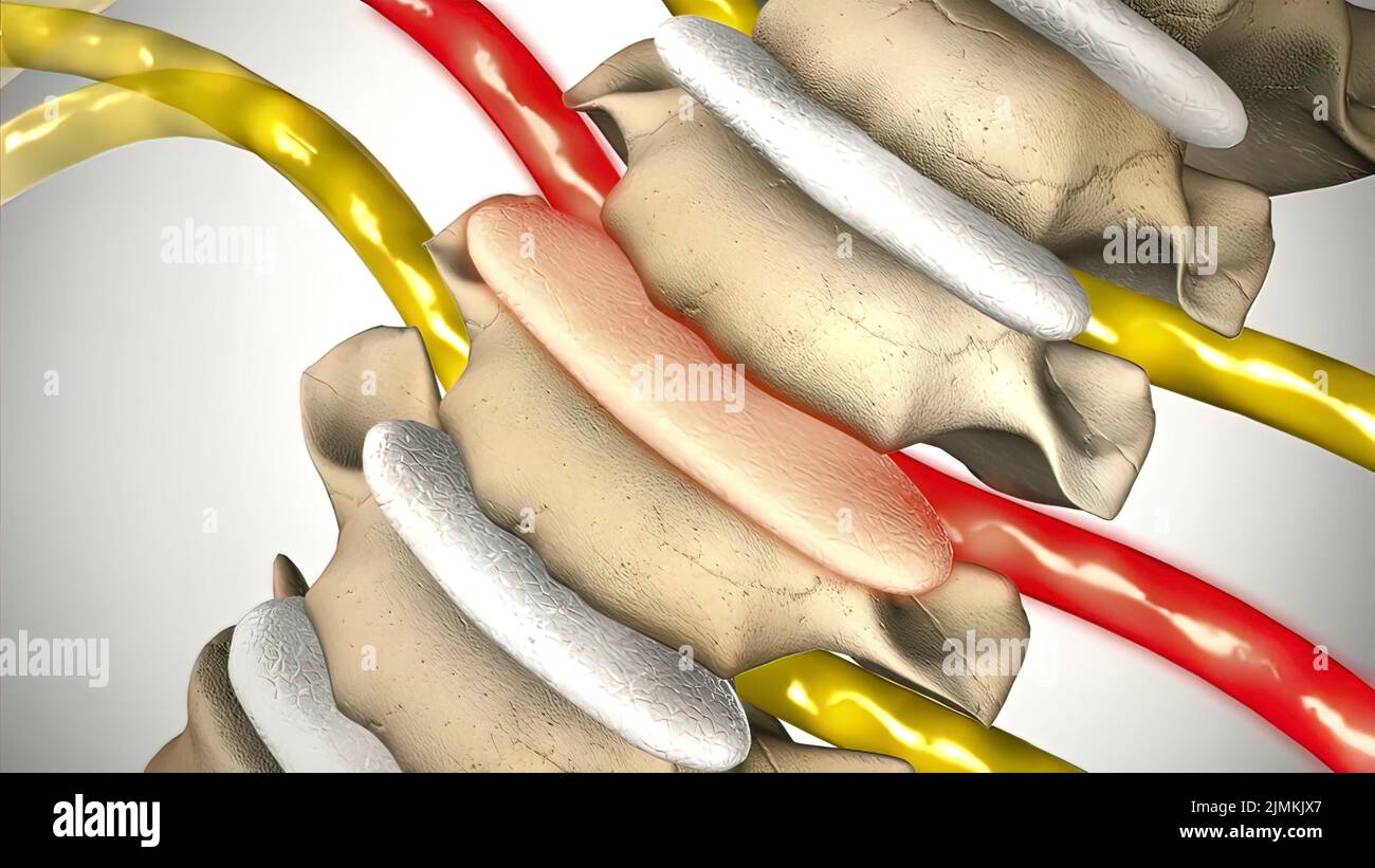 Network of nerves hi-res stock photography and images - Alamy