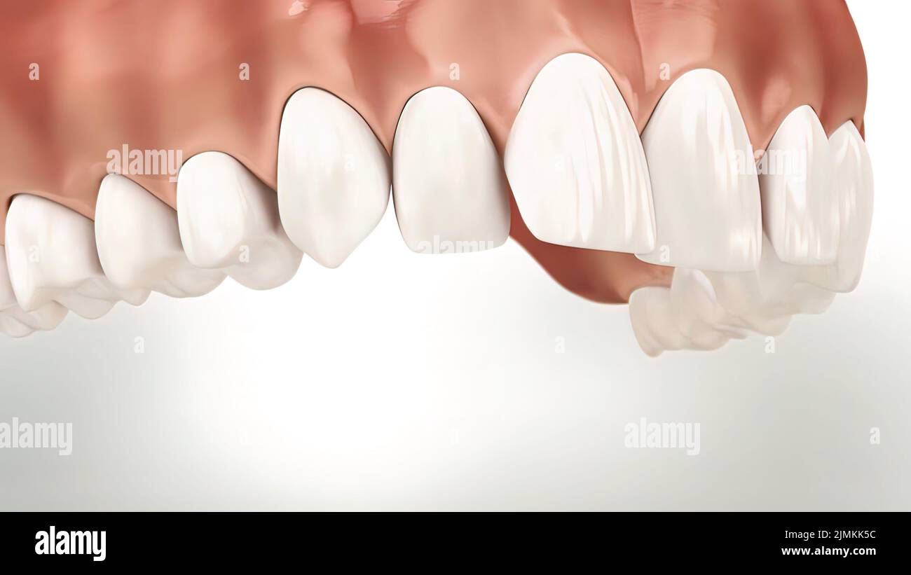 Dental process hi-res stock photography and images - Alamy