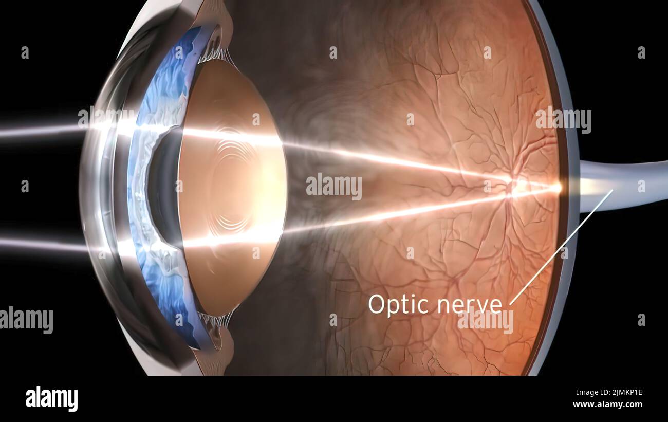 Medically accurate hi-res stock photography and images - Alamy