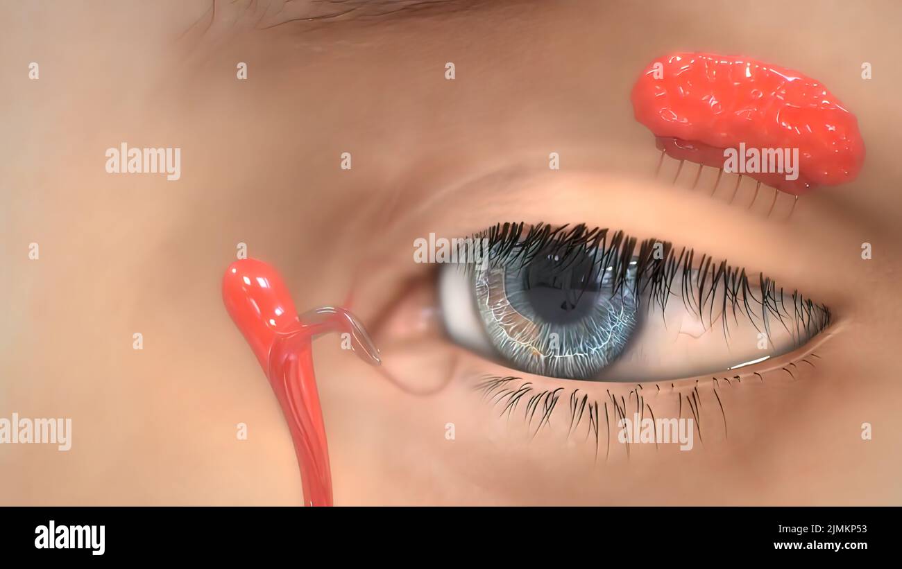 Meibomian glands hi-res stock photography and images - Alamy