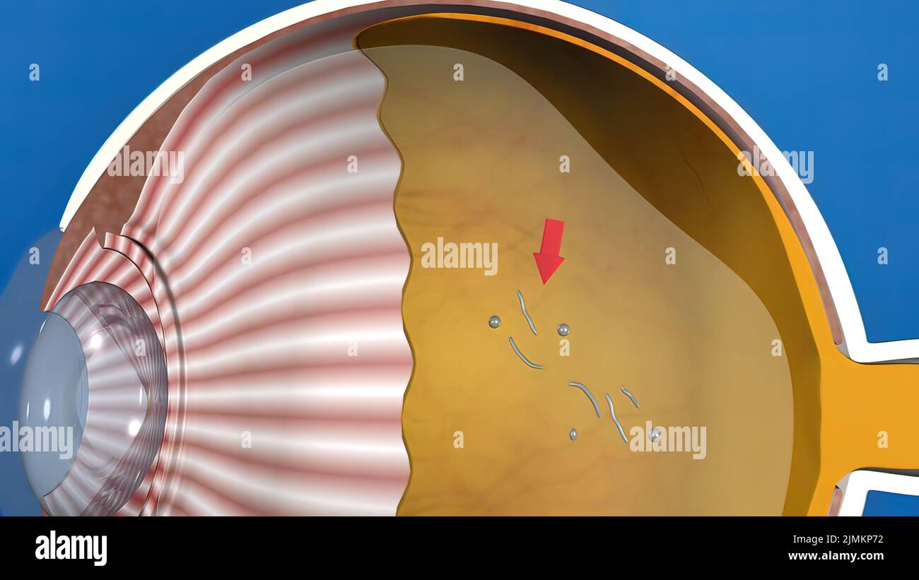 Eye doctor illustration hi-res stock photography and images - Alamy
