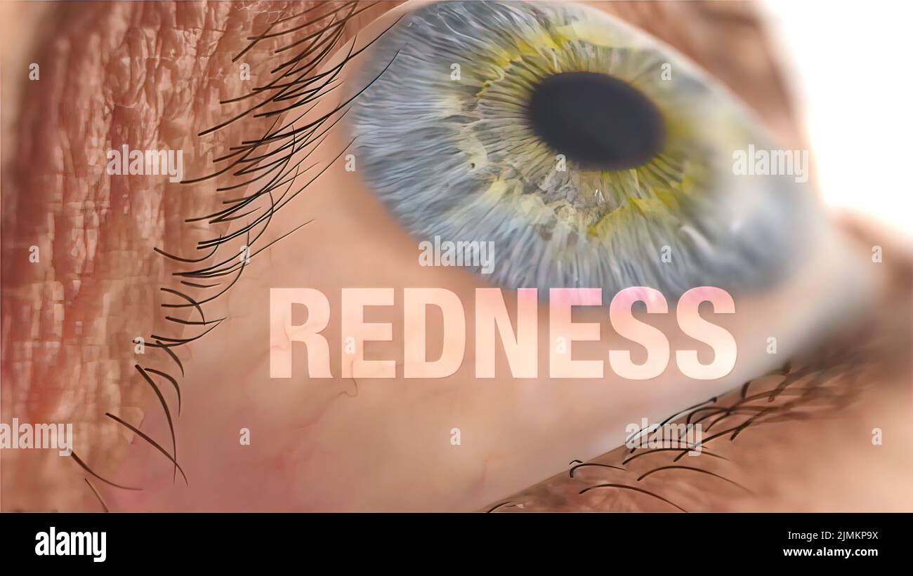 Facial inflammation hi-res stock photography and images - Alamy