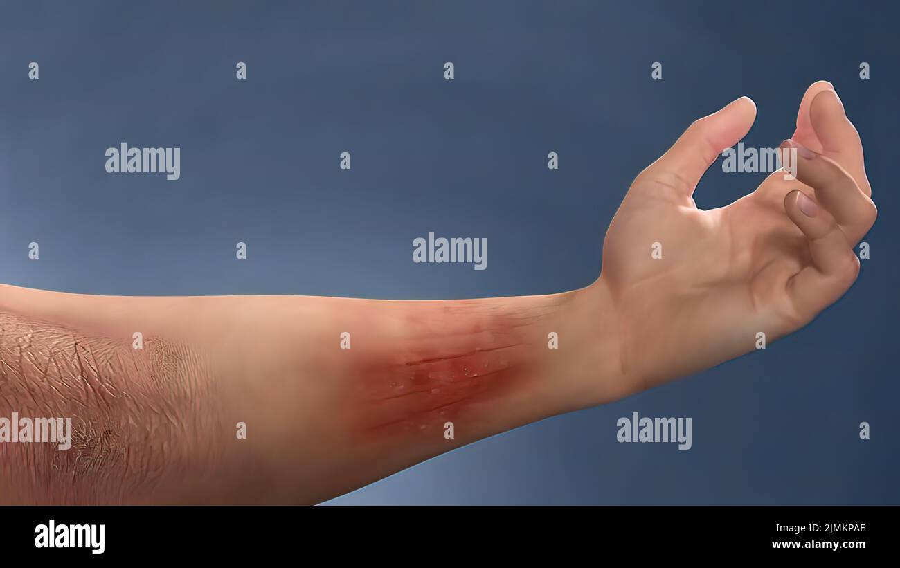 Human skin diagram hi-res stock photography and images - Alamy