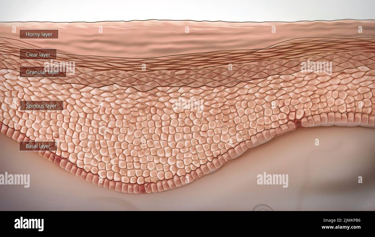 Thermal burn skin hi-res stock photography and images - Alamy