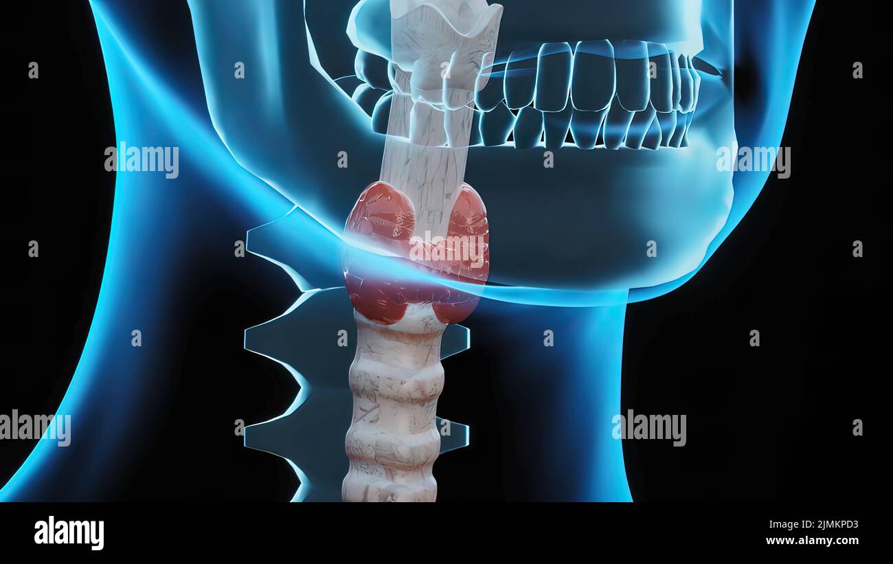 Science medical goiter nodular hi-res stock photography and images - Alamy