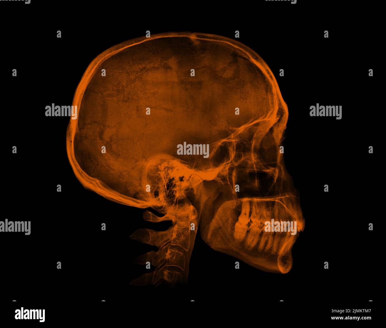 Human skull. Orange X-ray image on black background Stock Photo - Alamy