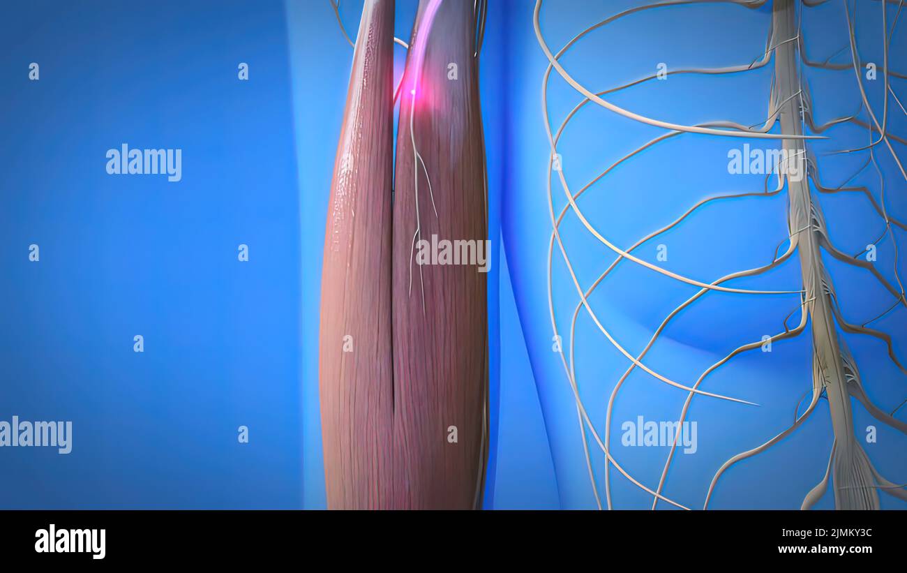 Signal of brain hi-res stock photography and images - Alamy