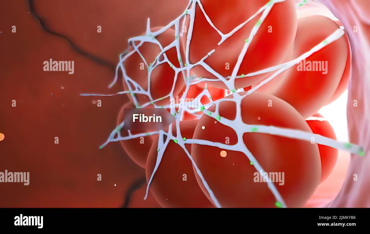 Red blood cell fibrin mesh hi-res stock photography and images - Alamy