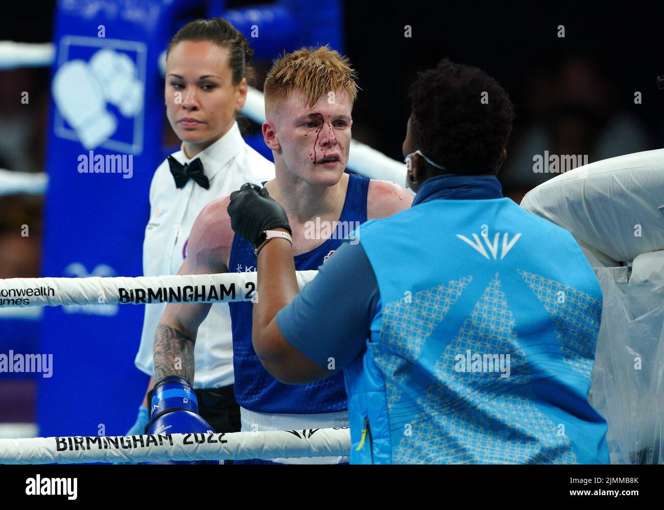 England's Kiaran Macdonald (Blue) with a cut above the eye in the bout ...