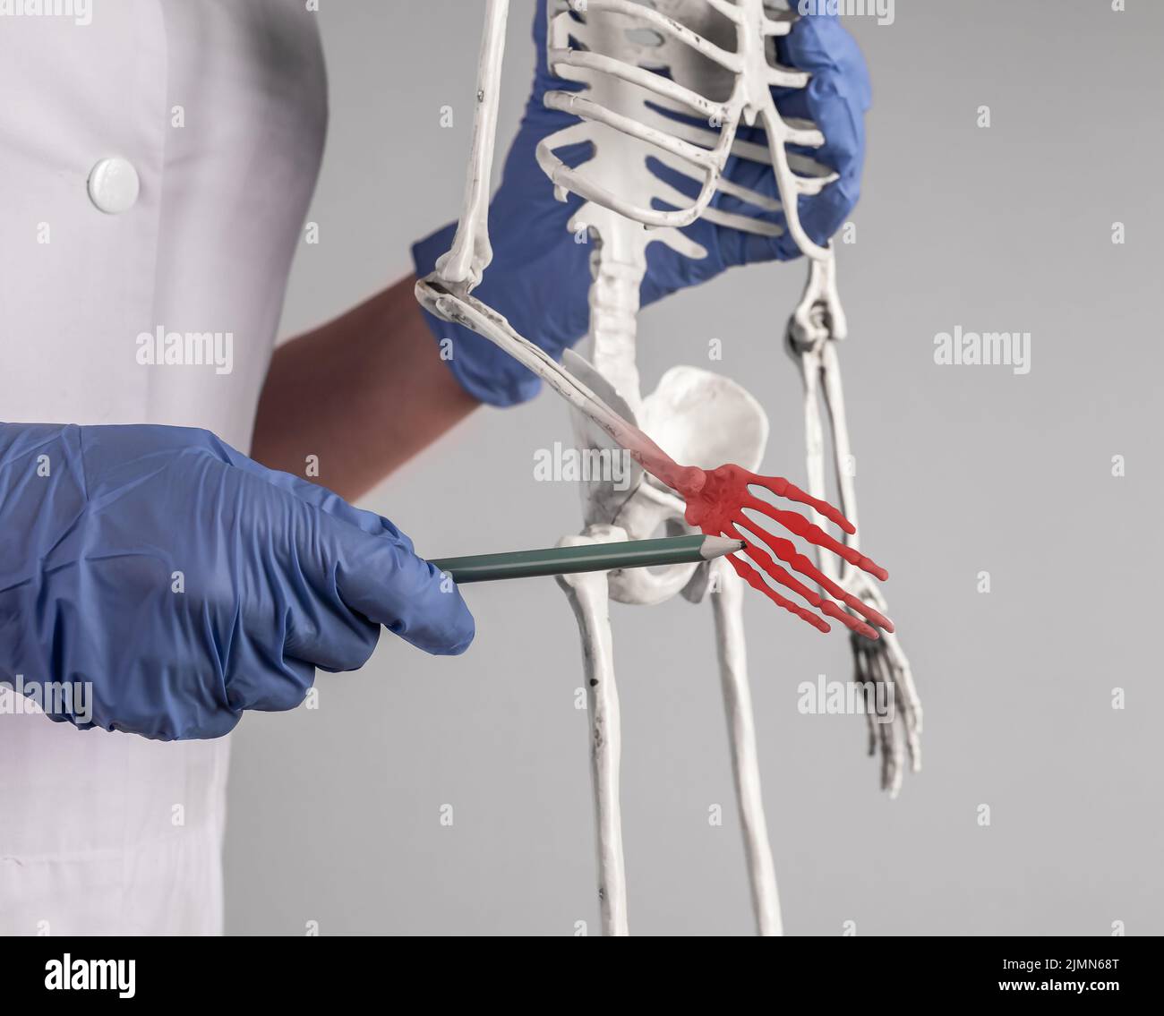 Doctor pointing to skeleton hand with red point. Fingers pain. Skeletal ...
