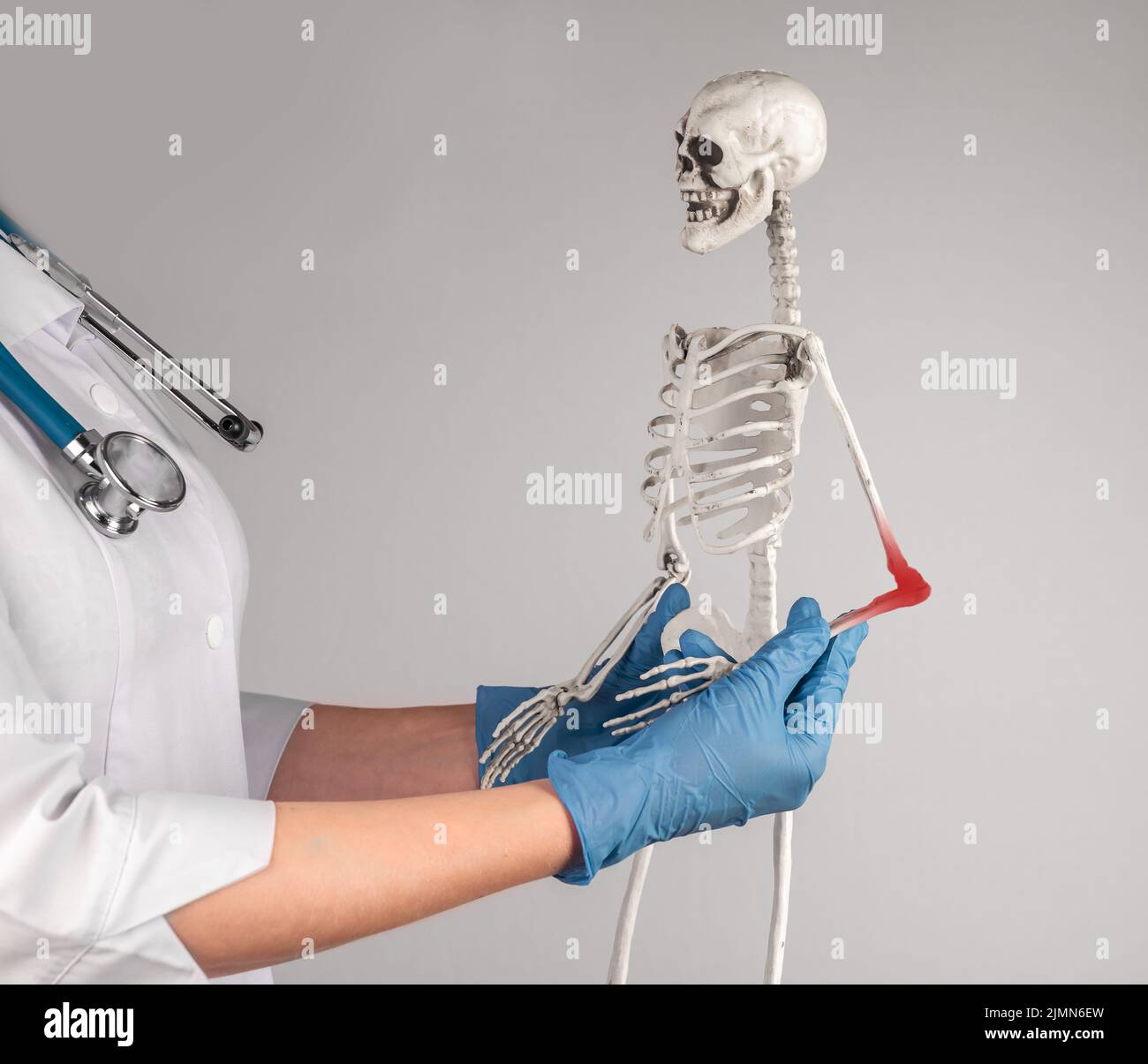 Doctor holding skeleton arm with red elbow and explaining to patient ...