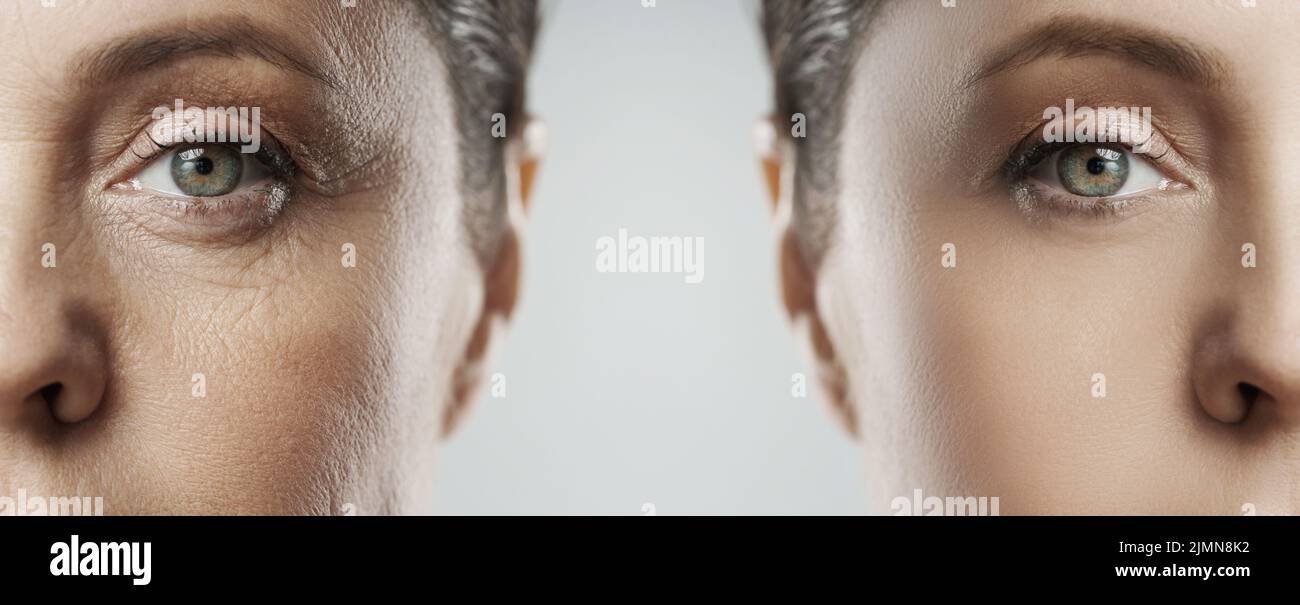 Female face after incredible rejuvenation process or heavy retouching ...