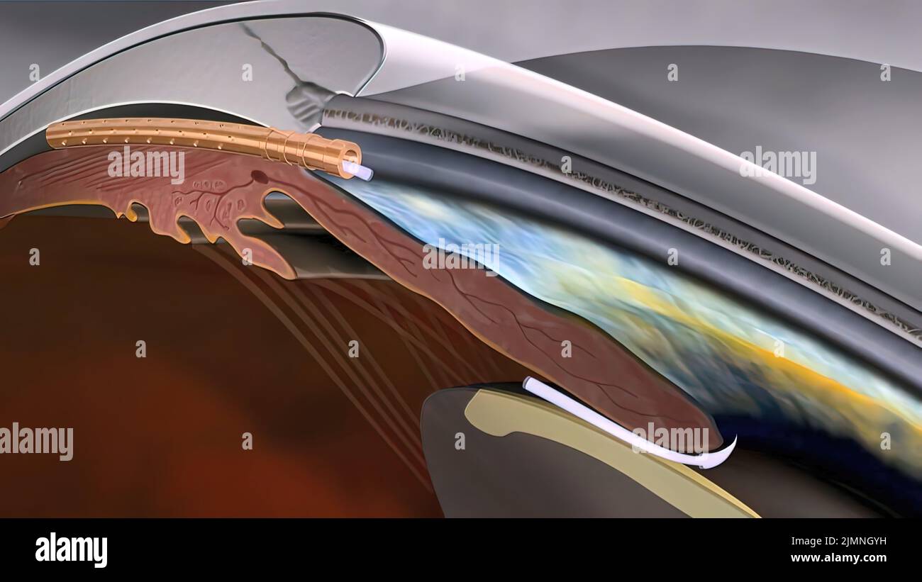 Lacrimal vein hi-res stock photography and images - Alamy